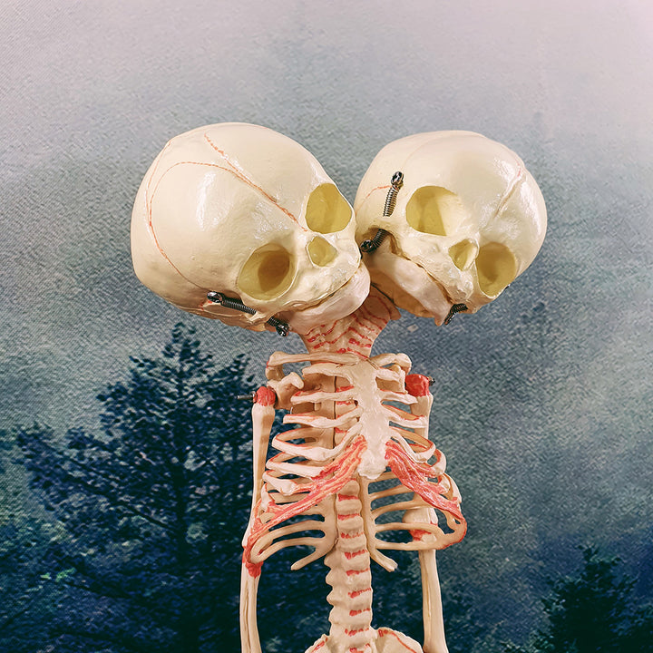 Fetal Conjoined Twins Anatomical Model